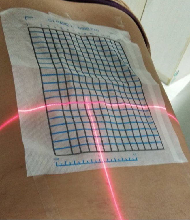 CT RAPID GUIDING PAD - Buy, CT RAPID GUIDING PAD Product on YANGZHOU ...