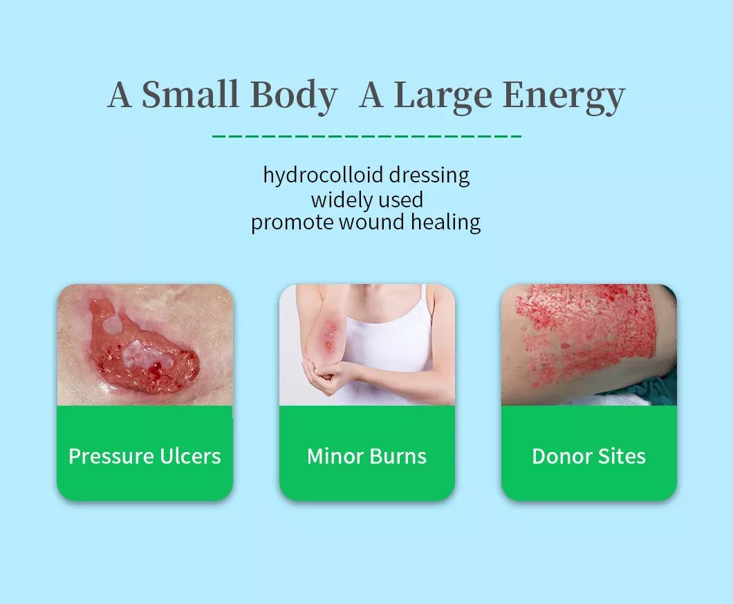Hydrocolloid Dressing - Buy Colostomy Bag, Two-Piece Velcro, Two Pieces ...