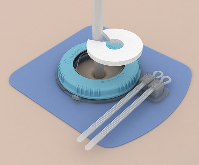 Loopix Wound Drainage Tube Fixing Device for The Fixation of Drainage ...